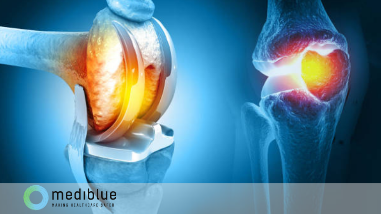 Products - Mediblue Healthcare Private Limited